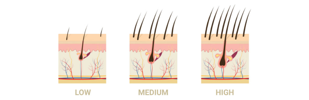 What’s My Hair Type? Discover the 4 Hair Types in 4 Easy Steps - De ...