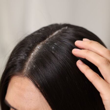 Smelly Scalp: 6 Simple Ways to Keep It Fresh