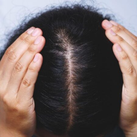 Smelly Scalp: 6 Simple Ways to Keep It Fresh